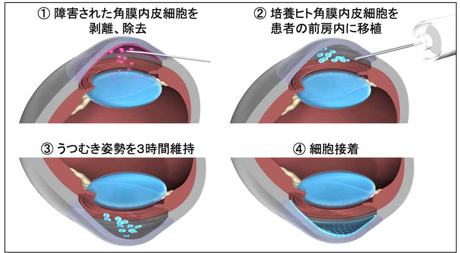 再生医療等製品#19 ビズノバ | 再生医療.net